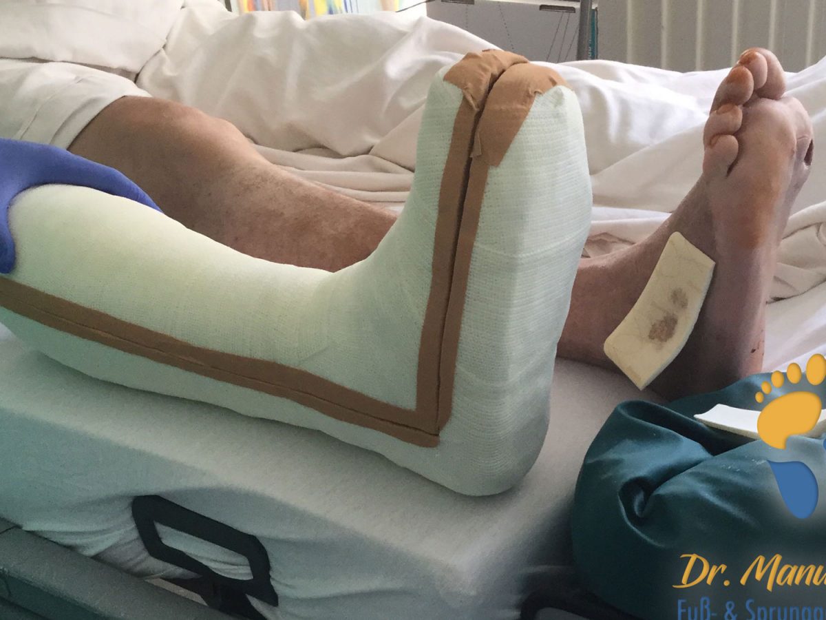 Malum perforans - Dr.-medic Manuel Nastai