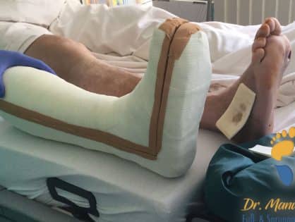 Malum perforans - Dr.-medic Manuel Nastai