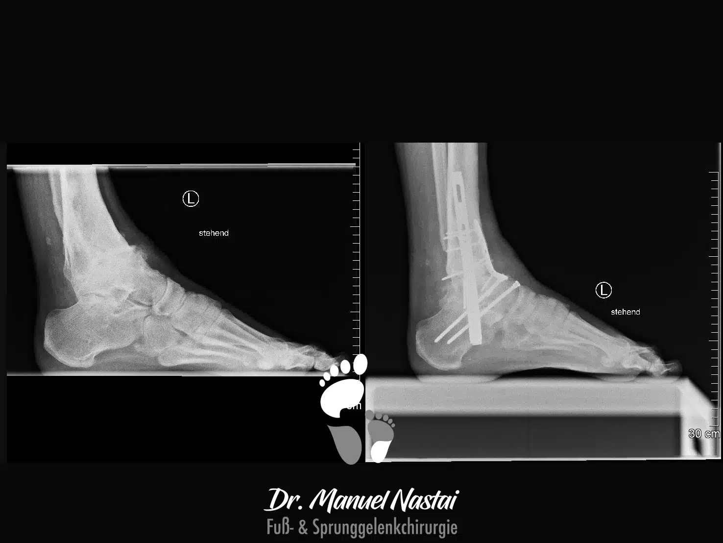 Fallvorstellungen Fuß- und Sprunggelenkchirurgie